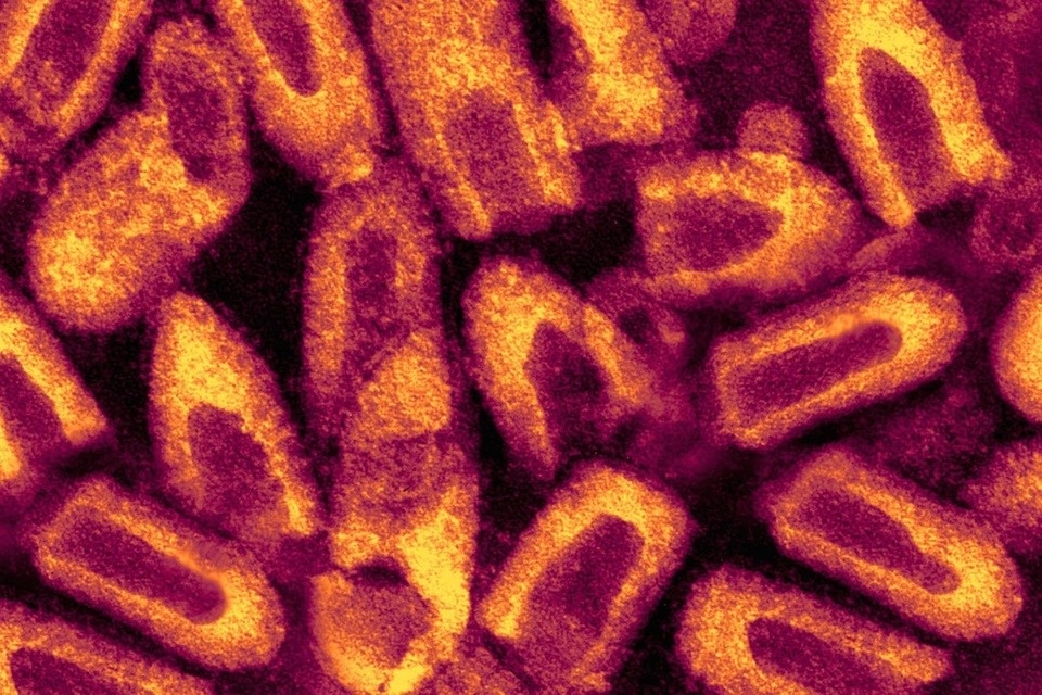 Cảnh báo loại virus nguy hiểm, đang chờ thời cơ bùng phát